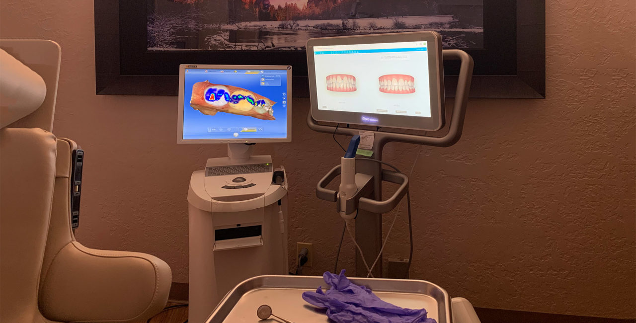 Teeth Straightening | ABQ Dentists